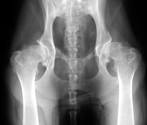 Hip Dysplasia – part 1 | Paragon Referrals | Wakefield